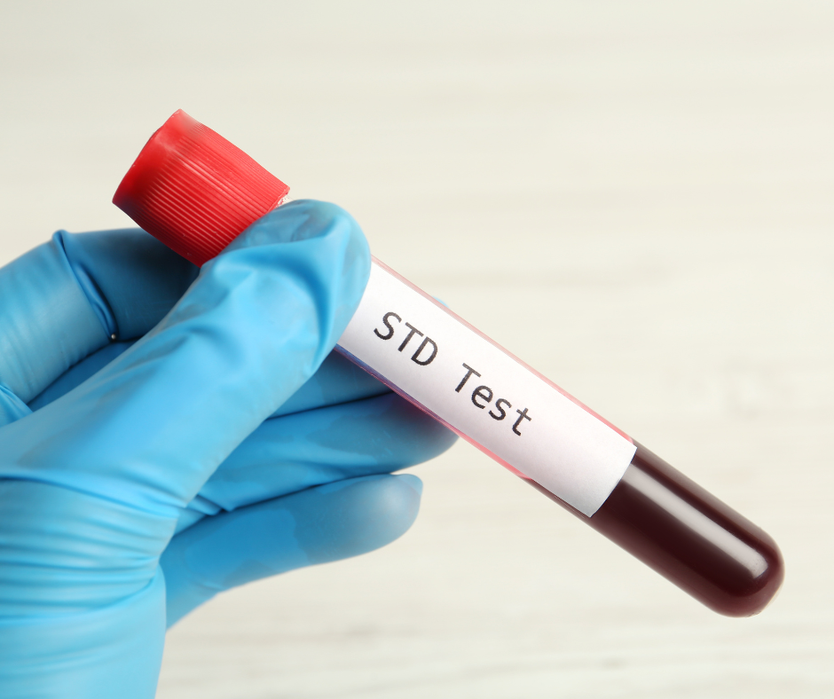 Can You Get STD Testing at Urgent Care? - Zip Clinic Urgent Care®